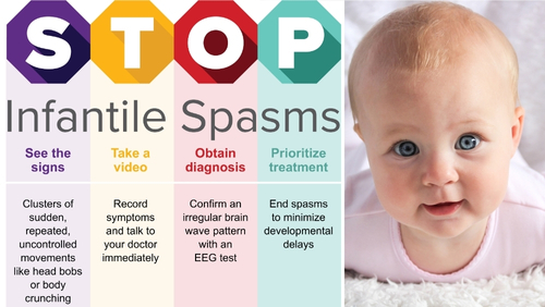 Infantile Spasms Awareness Week 2024: Early Detection Can Change Lives ...